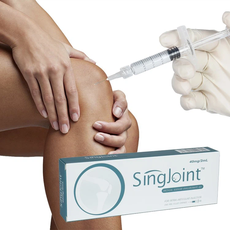 Singjoint có tốt không? Review chi tiết từ khách hàng