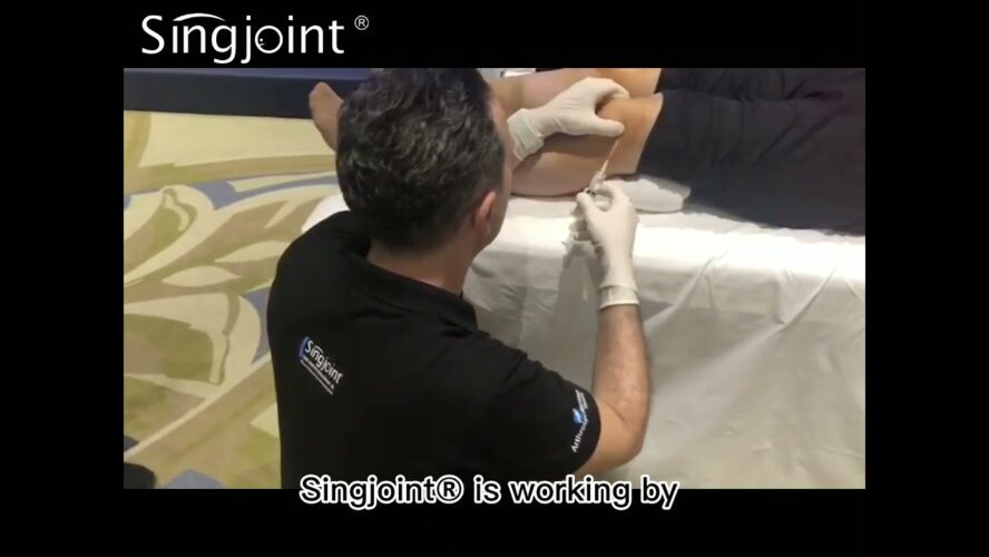 Tiêm dịch nhờn Singjoint – Giải pháp cho bệnh nhân thoái hóa khớp gối